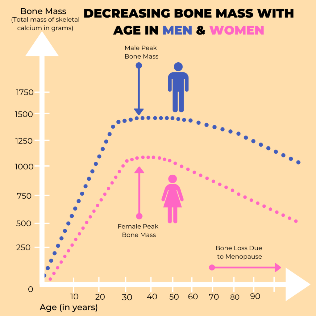 Osteoporosis: Detecting And Preventing The Silent Disease - Medical ...